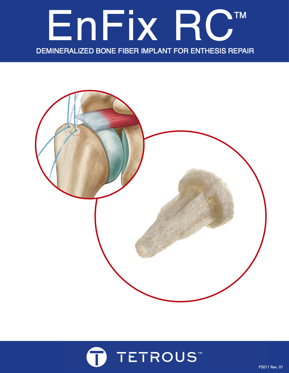 Resources – Tetrous