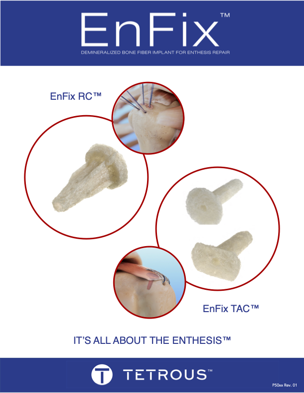 Resources - Tetrous, Inc.