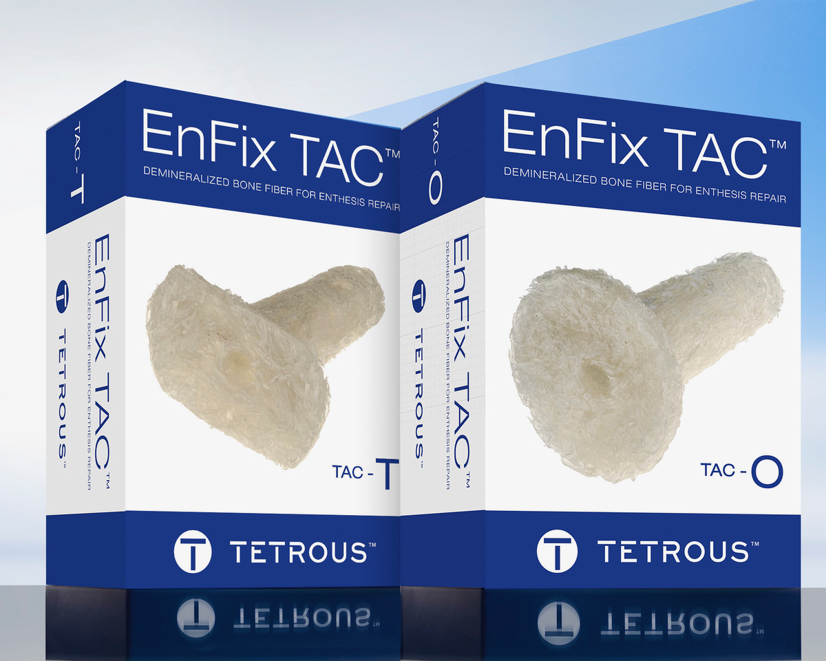 TETROUS, INC. ANNOUNCES THE LAUNCH OF THE ENFIX TAC® TO COMPLEMENT THE ...