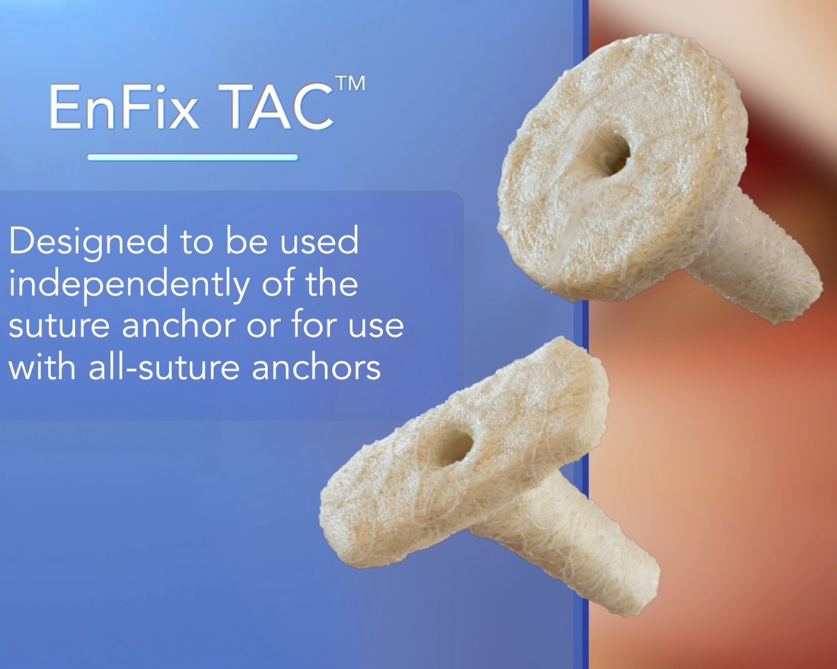 TETROUS ANNOUNCES FIRST SURGICAL PROCEDURES USING ENFIX TAC ...